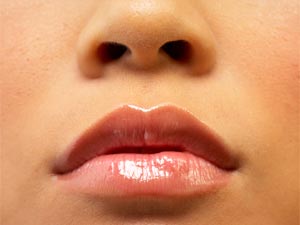 ಅಪ್ಪರ್ ಲಿಪ್ ಕಪ್ಪಿದ್ದರೆ ಈ ರೀತಿ ಮಾಡಿ | Dark Upper Lip Problem | How to ...